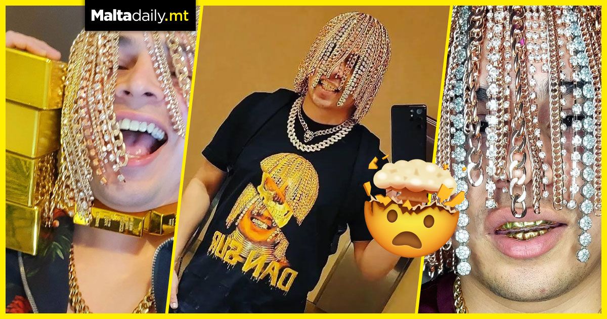 This rapper went viral after surgically implanting gold cha…